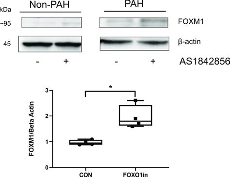 Effect Of Foxo1 Inhibition On Foxm1 Expression Cells Were Grown In