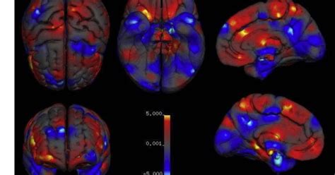 Cosmosophy Eeg Patterns Allow Sex Prediction With 80 Accuracy