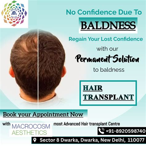 Best Hair Transplant Centre In Dwarka Delhi