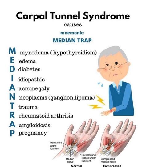 Carpal Tunnel Syndrome Medizzy