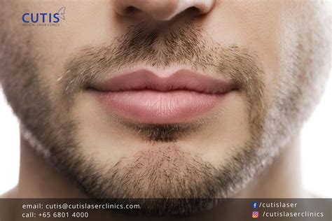 Lip Fillers What Men Can Expect