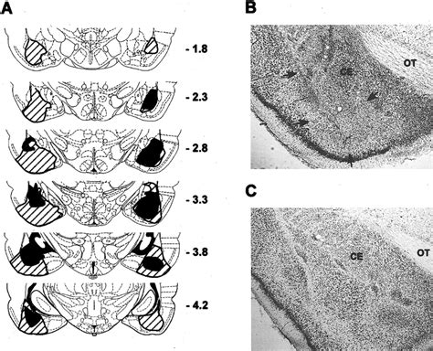 Lesions Of The Basolateral Complex Of The Amygdala Abl A Largest