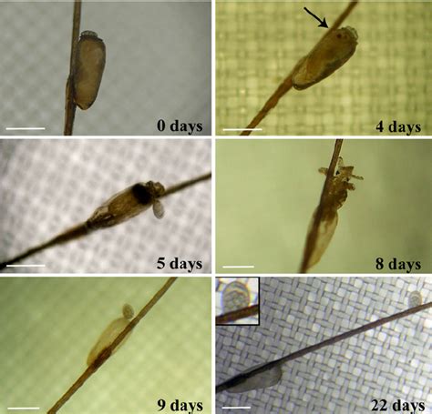 Live Lice Eggs