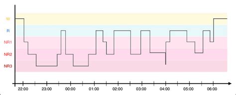 representative polysomnogram showing healthy sleep