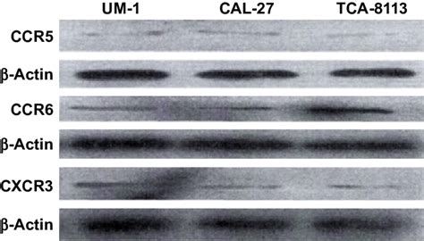 Expression Of Ccr5 Ccr6 And Cxcr3 In Three Human Tongue Squamous Cell