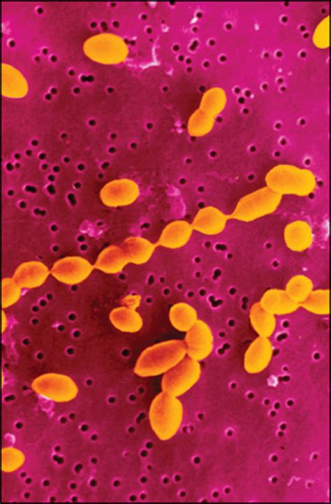 Preventing Pneumococcal Infections In Older Adults The Lancet