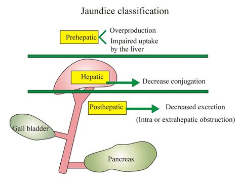 Bilirubin Part 1 Total Direct And Indirect Bilirubin