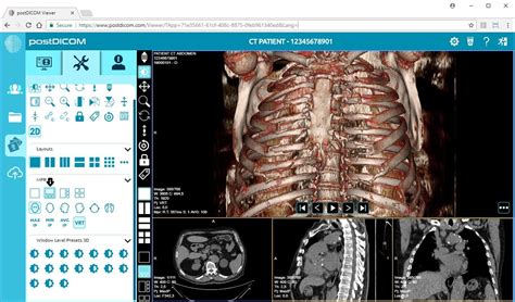 osirix dicom image library mevahill