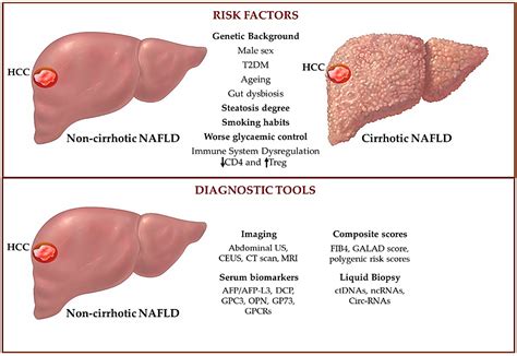 Biomedicines Free Full Text An Overview Of Hepatocellular Carcinoma