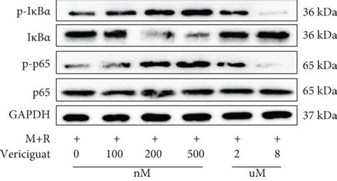 Vericiguat Dually Regulated Rankl Triggered Activation Of Iκb α Nf κb