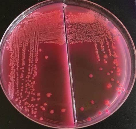 Escherichia Coli On Macconkey Agar Download Scientific Diagram
