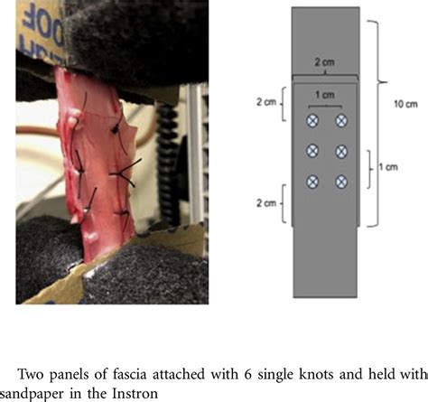 Optimization Of Suture Attachment For Fascia Sacral Colpopexy Using An