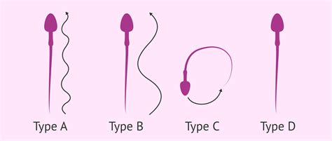 What Values Are Normal In Sperm Motility Analysis