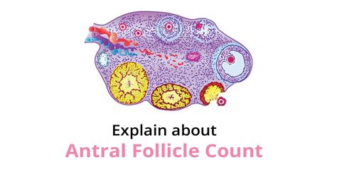 Understanding Antral Follicle Count Afc Birla Fertility And Ivf
