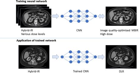 training and application of the deep learning reconstruction dlr