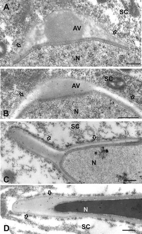Immunoelectron Microscopy Analyses Of Ultrathin Sections Through Mouse