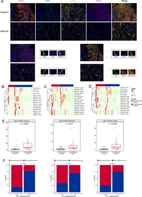 Comparison Of Pd L1 Expression And Til Infiltration In All Samples