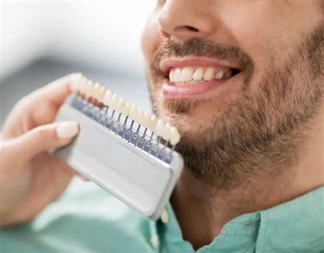 The Ultimate Guide To Dental Veneers For A Radiant Smile