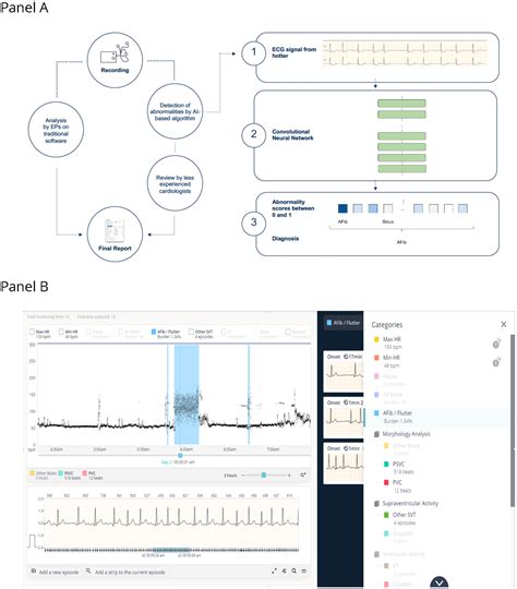 evaluation of an ambulatory ecg analysis platform using deep neural