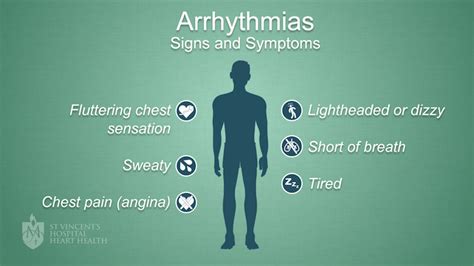 Arrhythmias St Vincents Heart Health