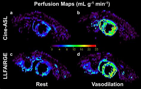 Cine‐asl A Steady‐pulsed Arterial Spin Labeling Method For Myocardial