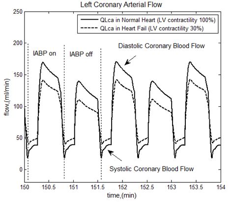 Arterial Pressure Waveform With Iabp 1 2 Upper Panel And With Iabp