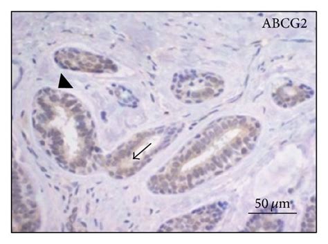 Expression Of A Abcg2 B Cd133 C Podoplanin And D Ki 67 In