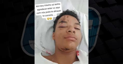 Adolescente De 16 Anos Que Se Envolveu Em Acidente Em São Mateus Do Sul
