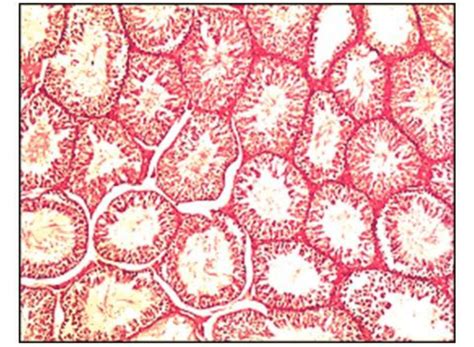 Histopathological Section Of The Testis Shows That The Testicular