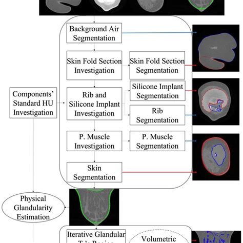 Breast Component Segmentation By Readers Top And Our Automatic