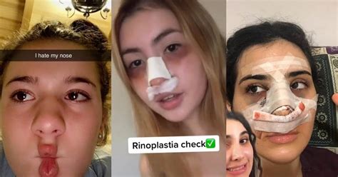 How Do You Get The Nose Job Filter To Work On Tiktok