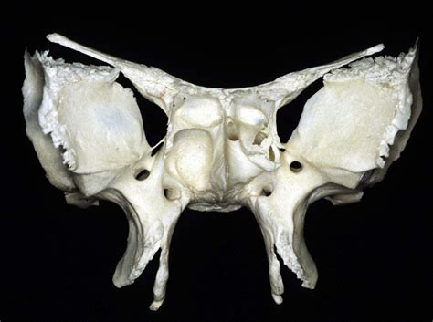 Anterior View Of Sphenoid Bone Neuroanatomy The Neurosurgical Atlas