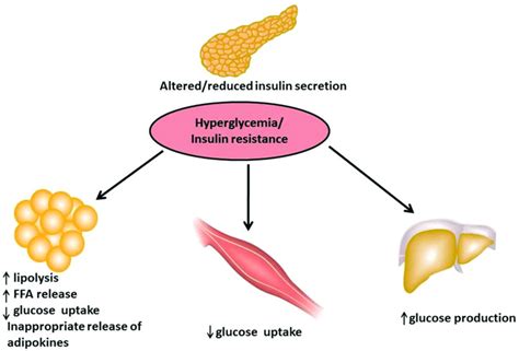 Pathophysiology Of Type 2 Diabetes Mellitus T2dm Download