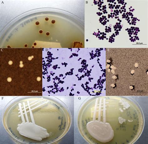 Cryptococcus Neoformans Var Grubii A Brown Colony Effect Bce On