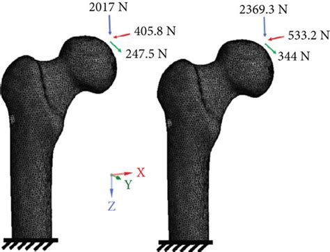 Meshing And Boundary Conditions A Meshed Model Of Proximal Femur