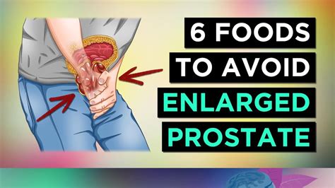 6 Foods To Avoid With An Enlarged Prostate Youtube
