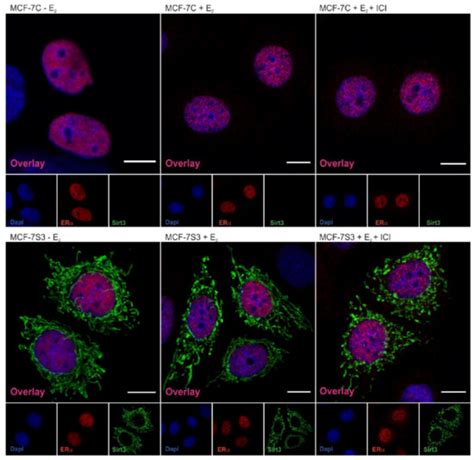 Antioxidants Free Full Text Sirt3 Exerts Its Tumor Suppressive Role