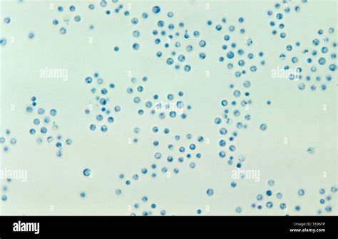 Photomicrograph Of The Encapsulated Yeast Cryptococcus Neoformans 1961