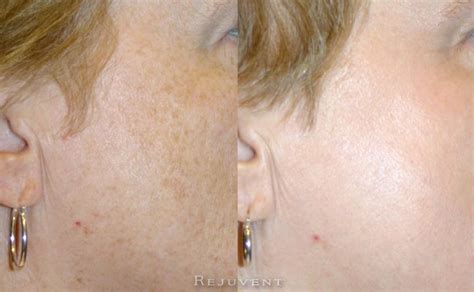 Looking Your Best In Your 50s • Rejuvent Medical Spa Scottsdale
