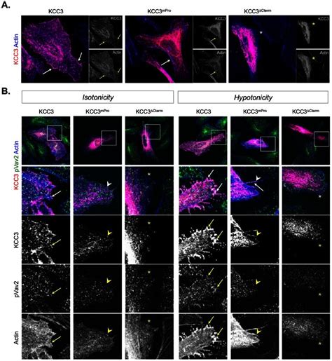 A Distribution Of Wild Type And Mutant Kcc3 Forms In Transiently