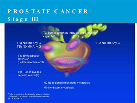 Ca Prostate