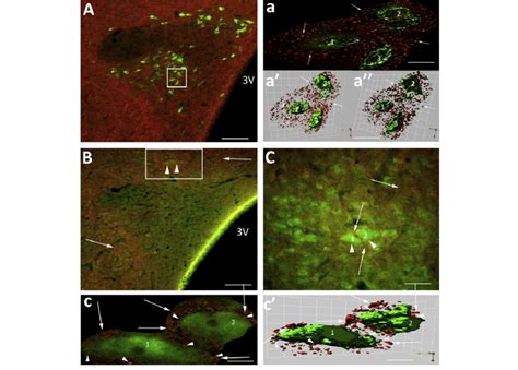 Relationship Between Spinally Projecting Gaba Neurons And Vglut2