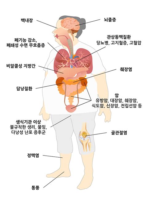 비만·대사수술센터