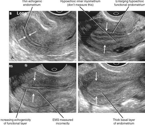 Female Reproductive System Radiology Key