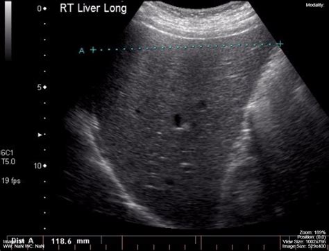 Ultrasound Us Undergraduate Diagnostic Imaging Fundamentals