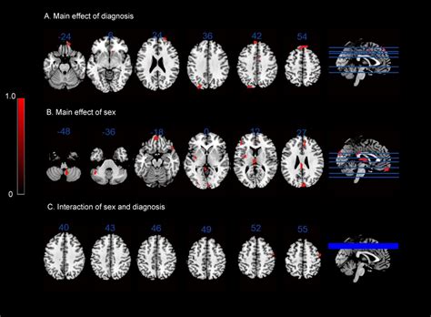 Frontiers Sex Differences Of Neural Connectivity In Internet Gaming