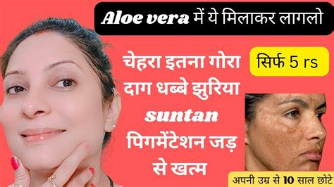 Apply Aloe Vera Gel Every Night And Get Fair Glowing Skin Crystal Clear