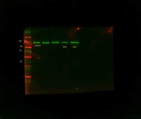 lab 8 western blot to detect e cadherin phosphorylation designing