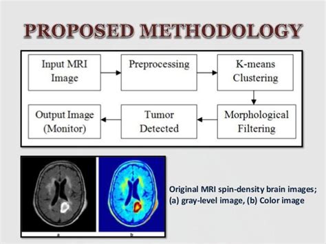 brain tumor mri image segmentation and detection in image processing