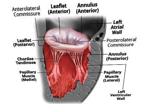 [figure Mitral Valve Anatomy Image Courtesy S Bhimji Md] Statpearls